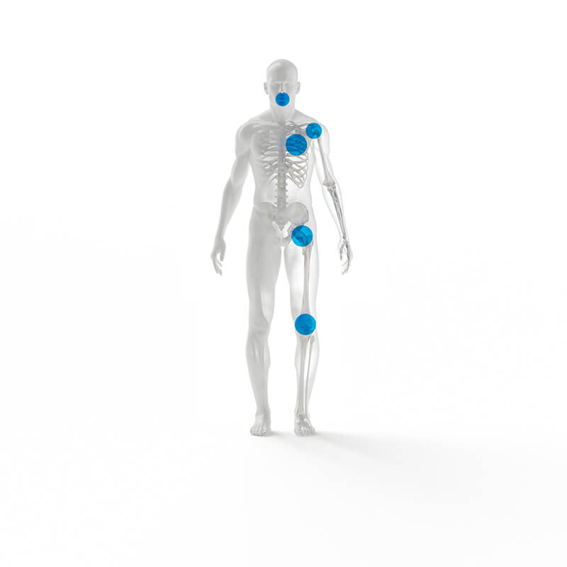MedTech Coatings - voestalpine HPM (Australia) Pty Ltd